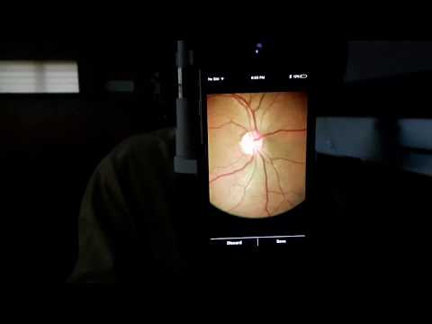 Fundus Camera - Retinal Camera Latest Price, Manufacturers & Suppliers