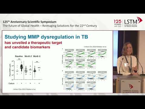 Can we end TB by 2030?