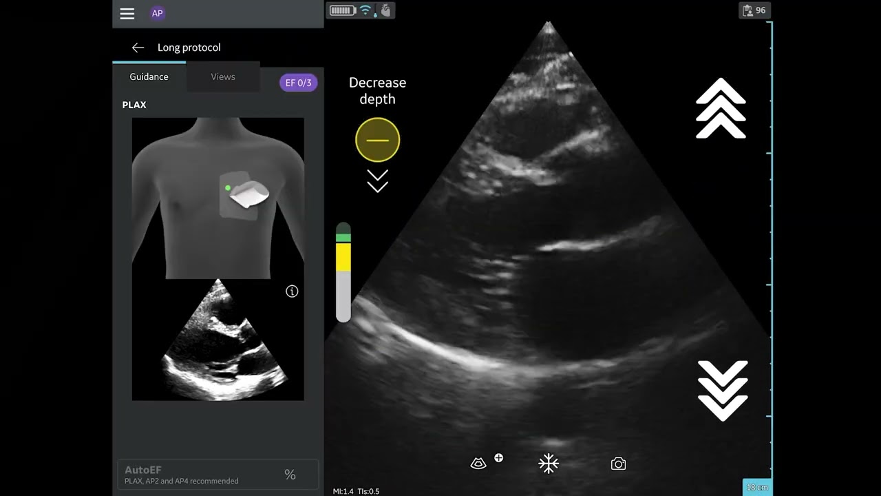 Prescriptive Guidance for Left - Handed Scanners