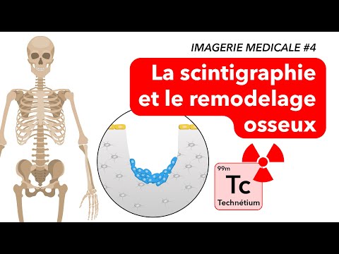 IMAGERIE MEDICALE #4 : La scintigraphie et le remodelage osseux