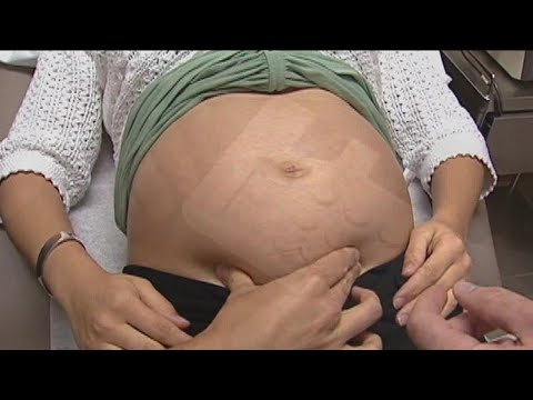 Maternal, infant death rates high in states with restrictive abortion laws: Report