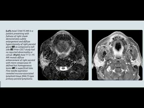 Head and neck radiology diagnostic imaging series images only(2)