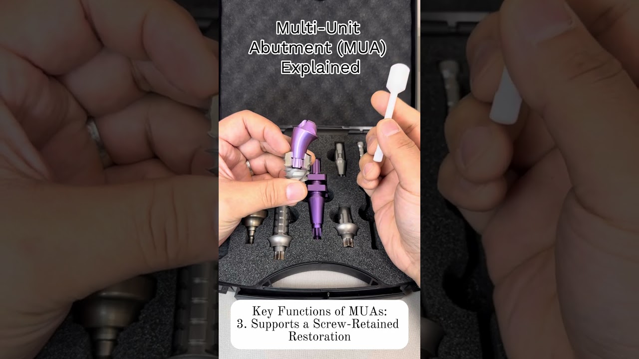 Multi-Unit Abutments (MUA) Explained