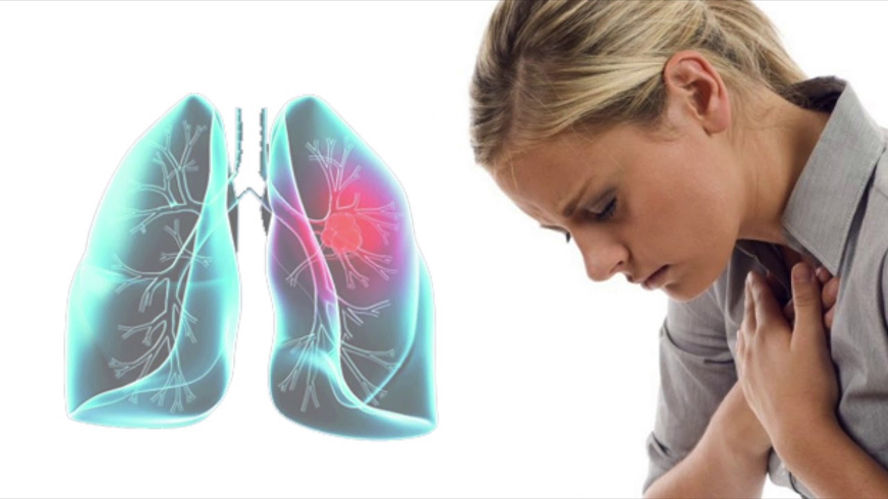 Smart Start Ignition Interlock Device kills and putting drivers in Danger