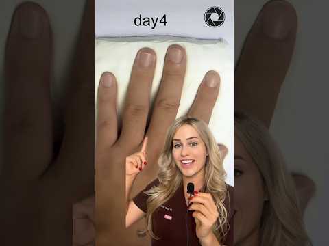What happens when you don't cut your fingernails?