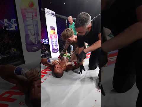 🚨FREE LIVE Stream RIGHT NOW!🚨 Gamebred Bareknuckle MMA (Link in Description)