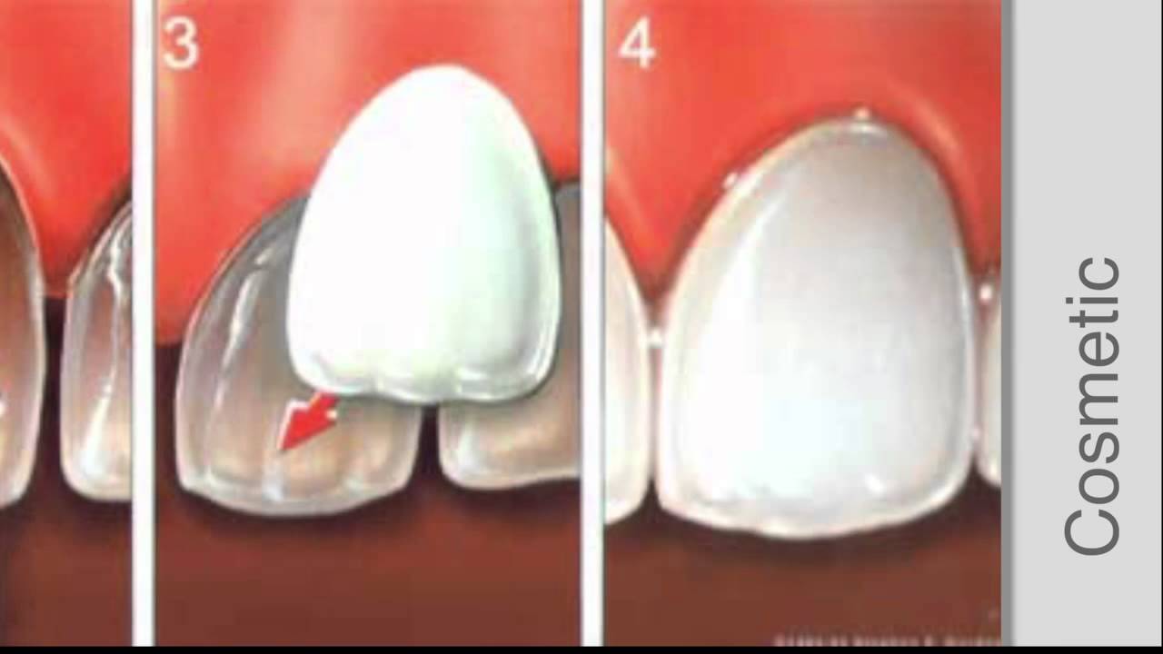Arsmiles Family and Cosmetic Dentistry - Services HD