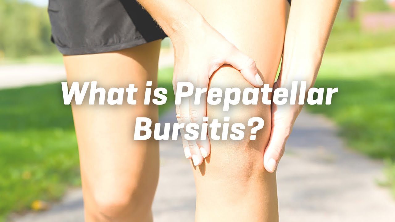 What is Prepatellar Bursitis?