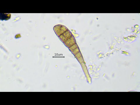 Growing of hyphae and septa formation in Alternaria sp. - fast time lapse