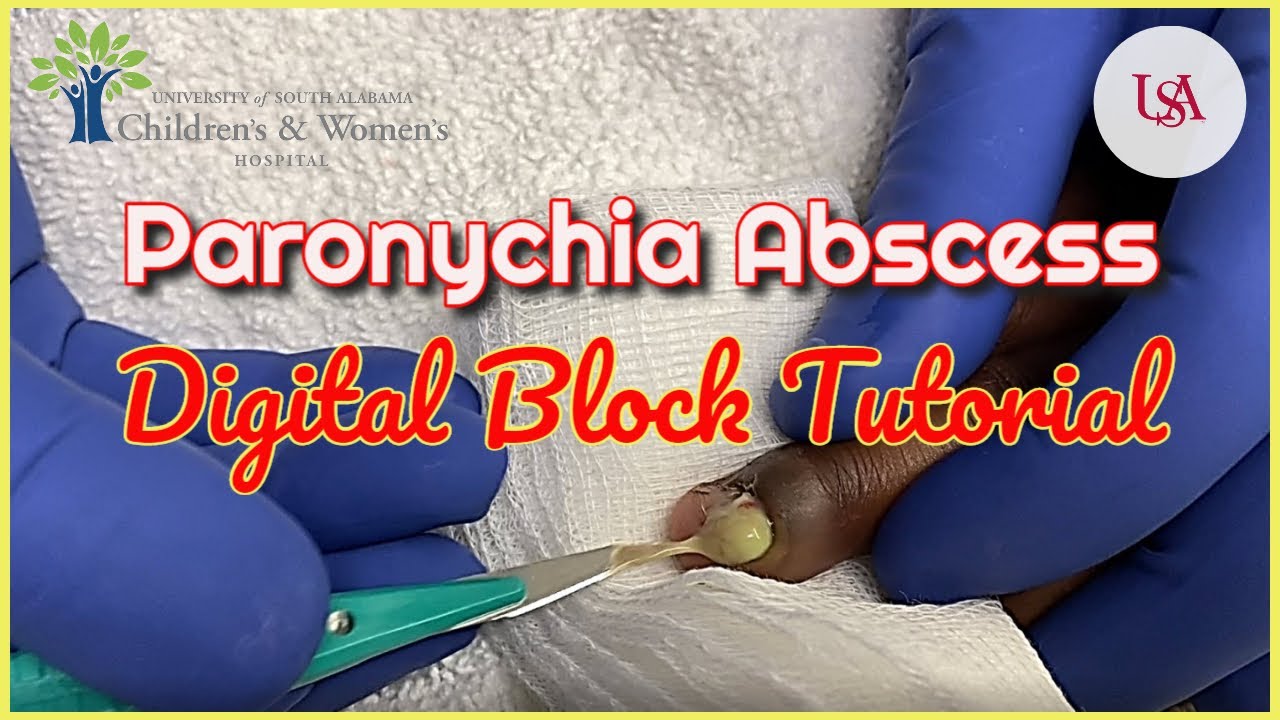 Digital Block and Finger Paronychia Drainage - EB Medicine