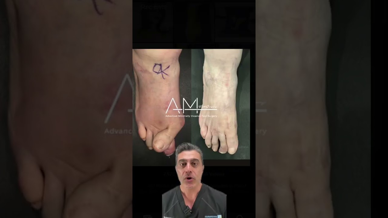 Celebrities with foot condition - Beau Garret