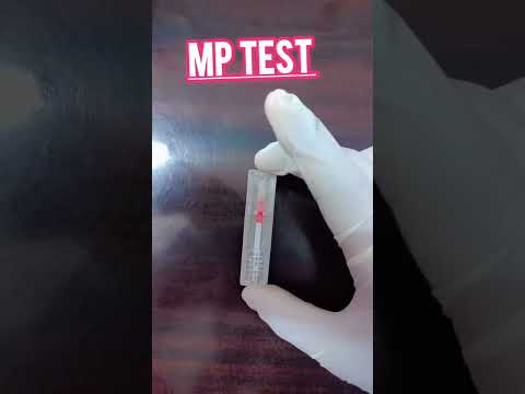 mp test // Malaria test #Malaria #youtubeshorts #girishchandra blood test