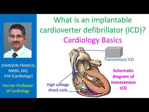 What is an implantable cardioverter defibrillator (ICD)? Cardiology Basics