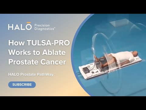 How Does the TULSA Procedure Prostate Cancer Treatment Work? Dr. Karamanian Explains (3D Simulation)