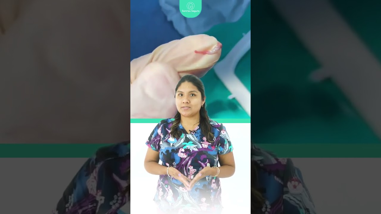 La pulpa dental 👀