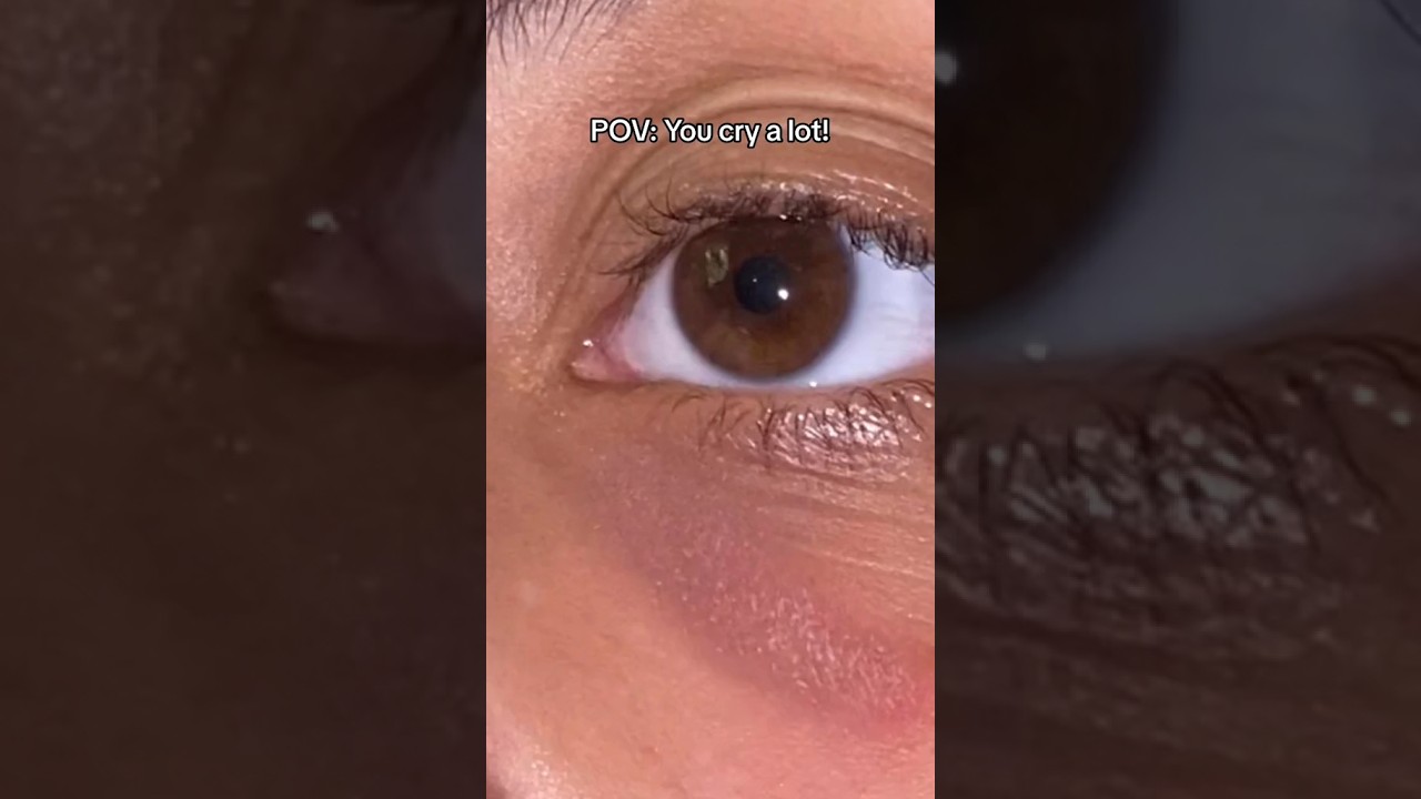 Crying a lot can also cause puffy eyes and dark circles! #crying