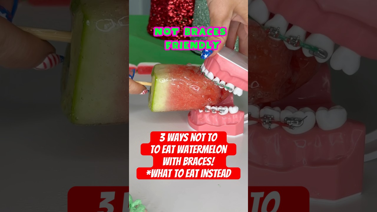 3 ways NOT to eat WATERMELON with BRACES *what to eat instead 🍉 #braces #watermelon #summer