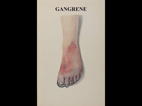 شرح GENERAL PATHOLOGY 39 gangrene DR SAMEH GHAZY معتمد - منصة معارف