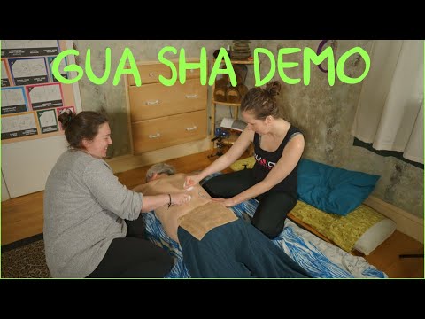 Gua Sha Scraping Massage Therapy on the Back with a Ceramic Soup Spoon