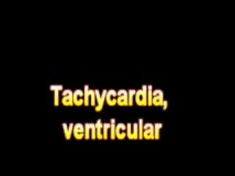 What Is The Definition Of Tachycardia, ventricular