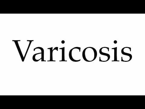 How to Pronounce Varicosis
