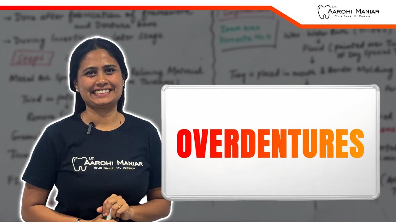 Overdentures | Prosthodontics