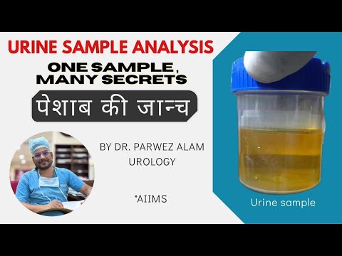 URINE ANALYSIS KA RESULTS EASY LANGUAGE ME || URINE TEST #parwezurology #urine
