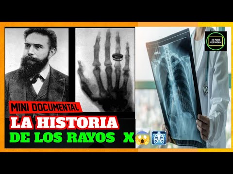 🩻¿Quien inventó los Rayos X?🤔🩻La Historia de los Rayos X🩻💀La Primera Radiografía😱🩻⚡