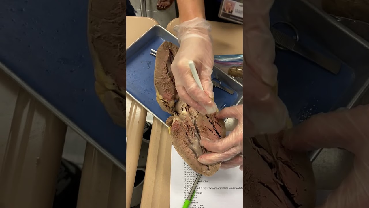 Pig Heart dissection: Internal Structures