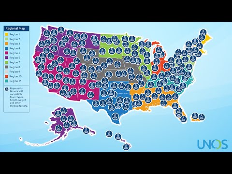 How the national organ transplant waiting list works