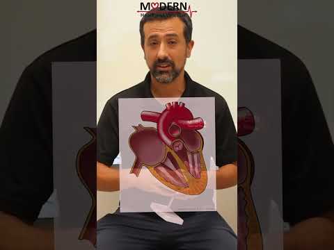What is Afib (Atrial Fibrillation)?