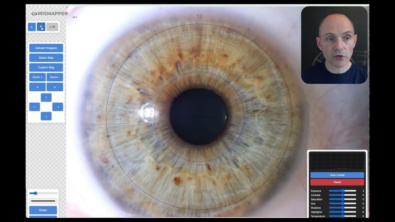 IrisMapper v5.1 - Demo - EN