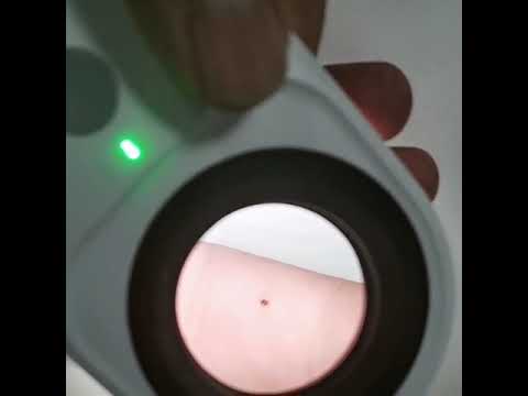 SIGMA LED Dermatoscope SD2