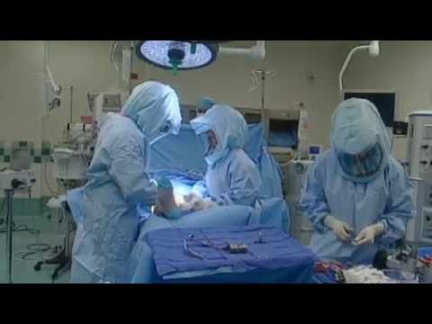 LEGION™ Total Knee System with VISIONAIRE™ Patient Matched Instrumentation
