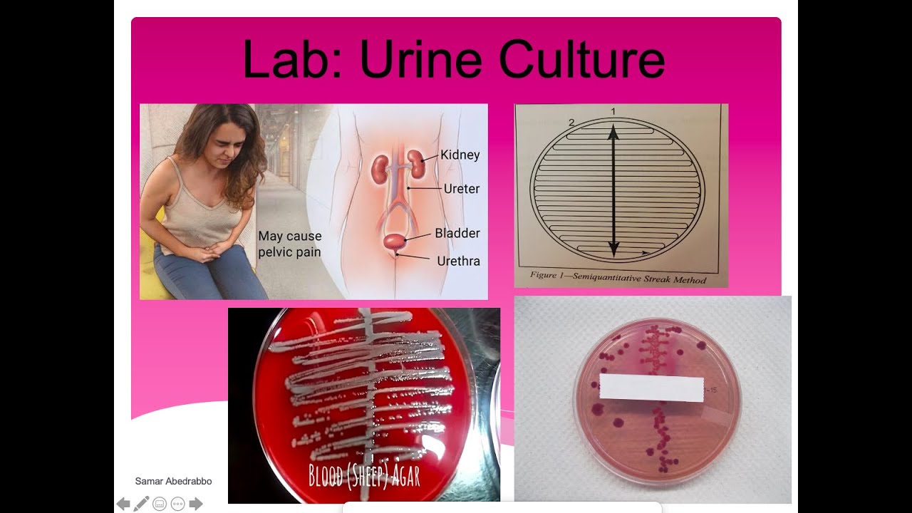 Urine Culture Lab