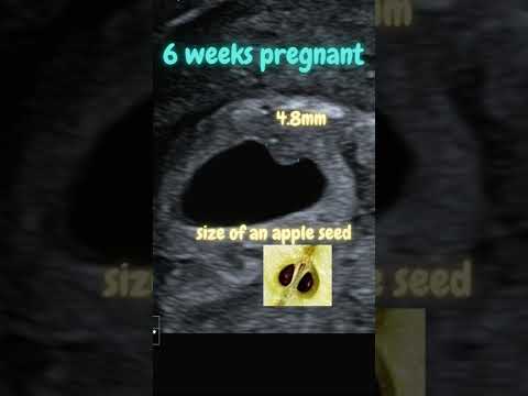 Watch the baby journey begins Ultrasound pregnancy 5 to 9 weeks