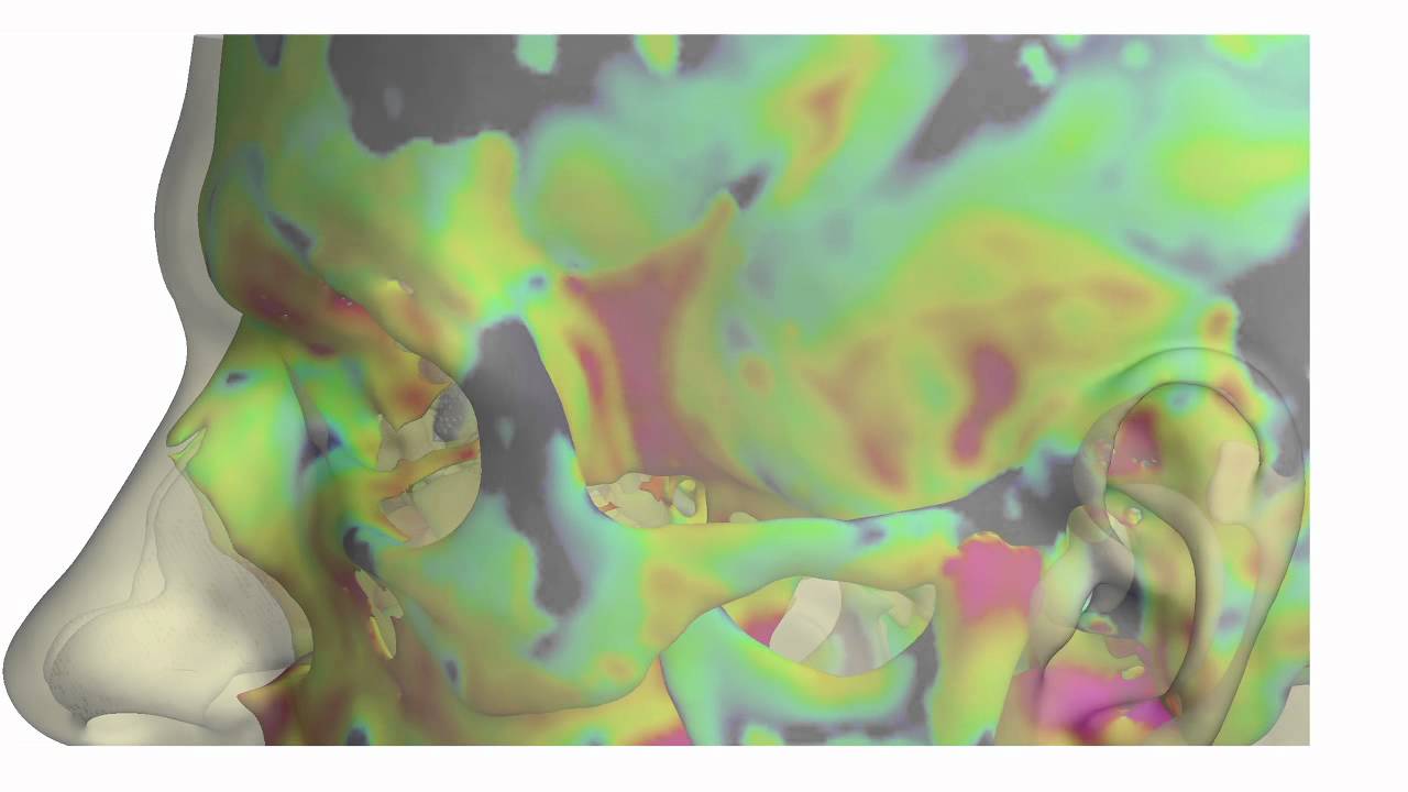 Cortical Thickness Mapping of the Skull