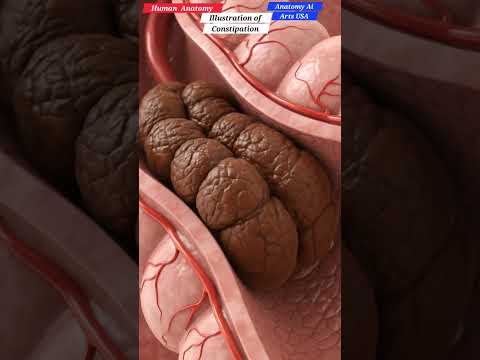 Illustration of Stool Constipation | Realistic AI Art | Gut Health | Anatomy AI Arts USA |