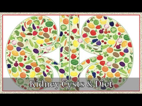 Kidney Cysts & Diet | Very Well