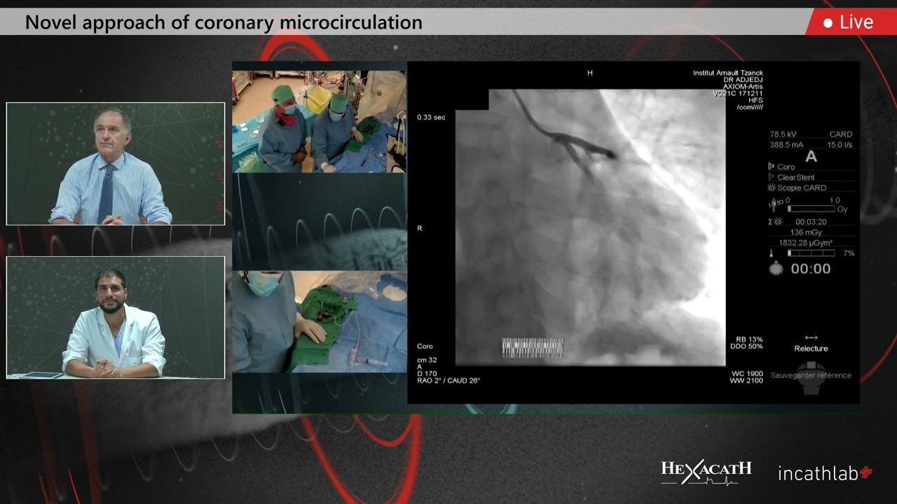 Microcirculation Clinical Cases with RayFlow by Hexacath 2021