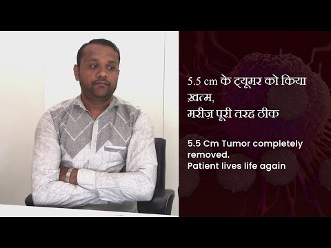 Best Cancer Treatment Hospital in India | Cancer Surgery Specialist ...