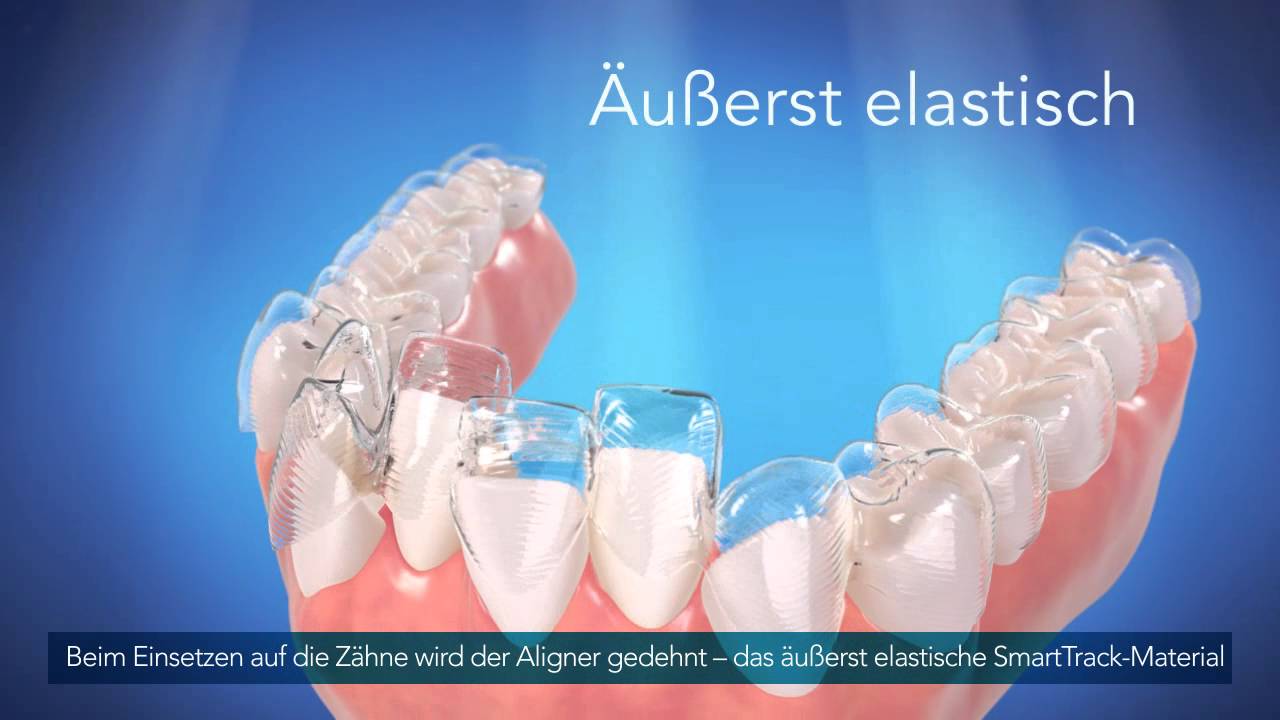 Invisalign SmartTrack