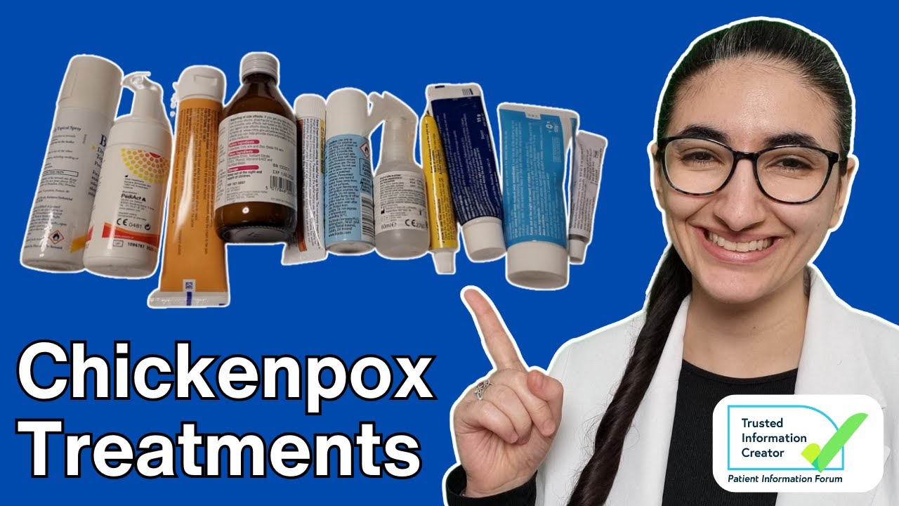 Chickenpox treatment: Pharmacist explains