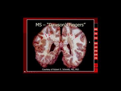 Neuro imaging: white matter diseases