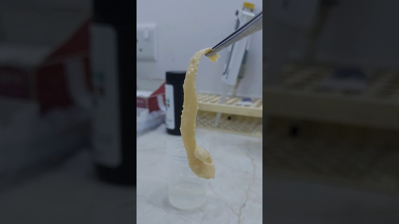 Watch the Adult Taenia saginata in Real Life!