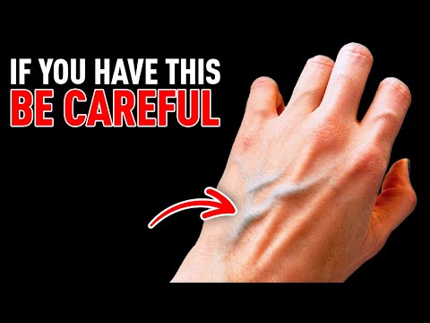How Rare Are You? Look at Your Hands to Find Out!