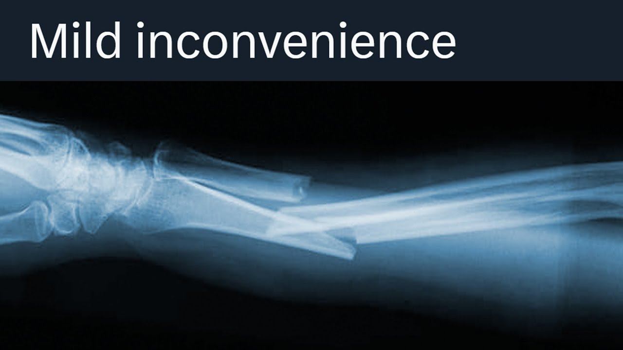 r/Lies | this is fine.