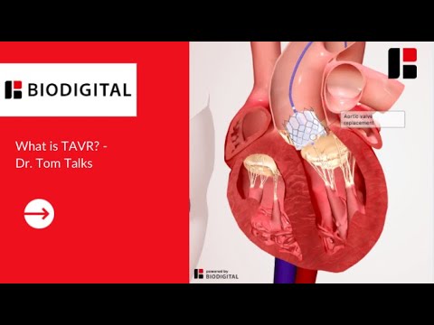 What is TAVR? - (Virtual) Dr. Tom Talks