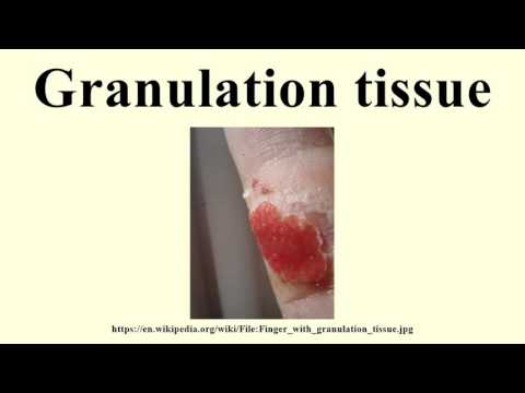 Granulation tissue