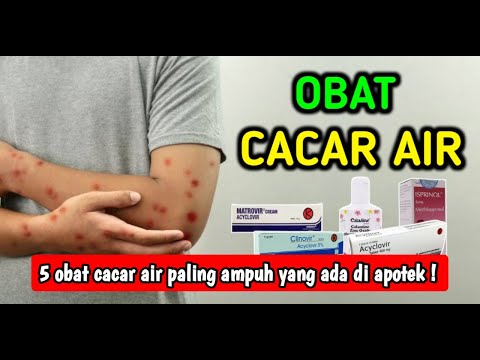 Obat Cacar Air Paling Ampuh | Obat Cacar Air